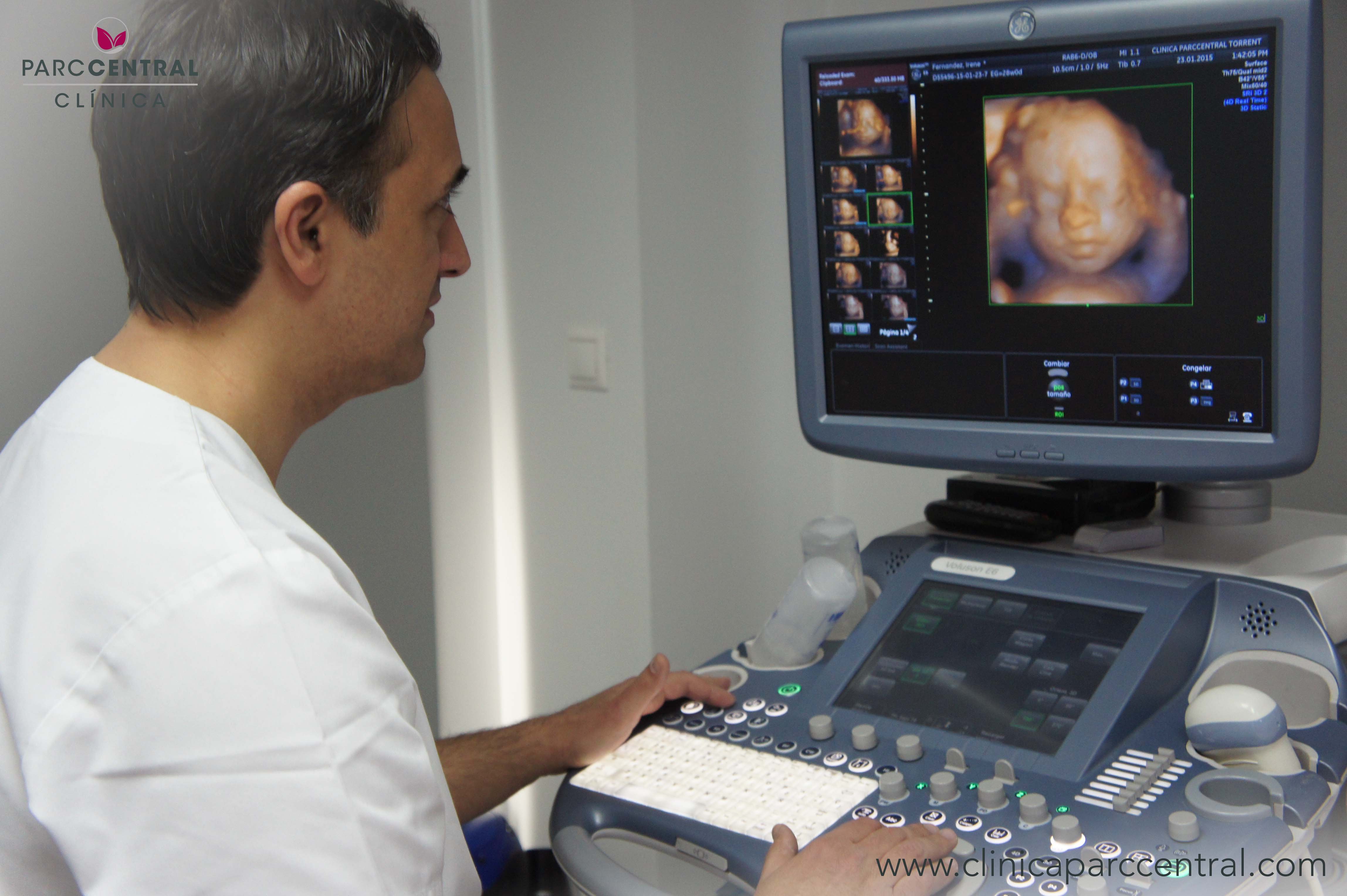DIFERENCIAS ENTRE ECO 5D 4D 3D Y 2D Clinica Parc Central DIFERENCIAS ENTRE ECO 5D 4D 3D Y 2D Clinica Parc Central